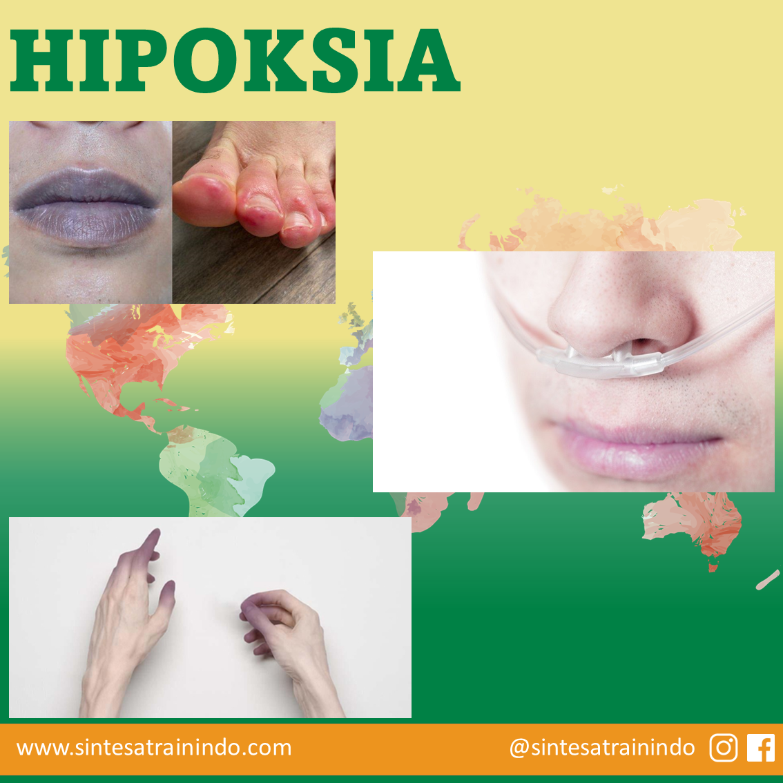 HIPOKSIA - Sintesa Trainindo